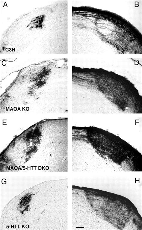 Excessive Activation Of Serotonin 5 Ht 1b Receptors Disrupts The
