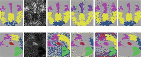Clustering Results On Axial And Sagittal Slices From Simulated Images