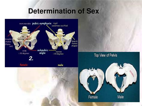 PPT Forensic Anthropology Studying Bones PowerPoint Presentation Free Download ID 5810178