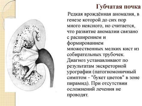 ВПР мочевыводящей системы - презентация онлайн