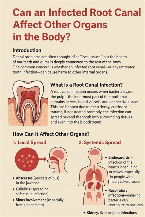 Root Canal Infection Causes Risks And Treatment Dr Hisana Abdul