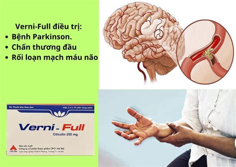 Thuốc Verni Full Điều Trị Rối Loạn Mạch Máu Não Dược Sĩ Lưu Văn Hoàng