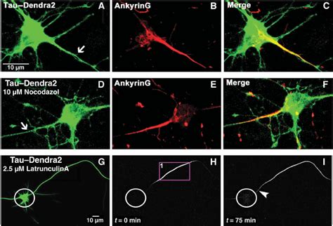 The Axonal Diffusion Barrier For Tau Coincides With The Axon Initial