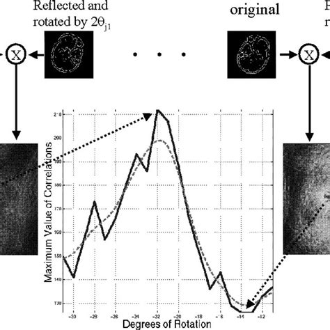 A Ideal Head Coordinate System X Y Z Versus The Imaging Coordinate