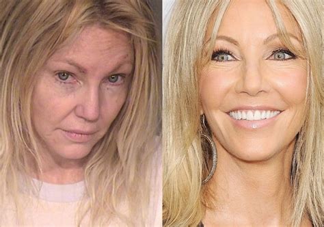 Heather Locklear Before And After Plastic Surgery Face Boobs