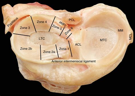 Meniscal Pathology Meniscus Anatomy Clinical Tree
