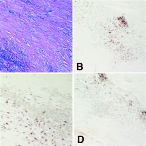 Pdf Review Of Isolated Ascending Aortitis Differential Diagnosis