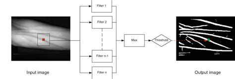 flowchart of the vessel detection method implementation download