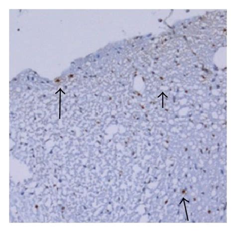 Expression Of Tunel Apoptosis Cells In The Spinal Cord Of Eae Mice