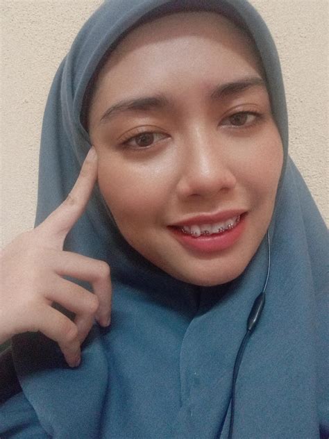 Ceramic Braces Or Metal Braces Braces