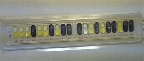 A Standard Profile Identification Api Anaerobic System Of Clostridium