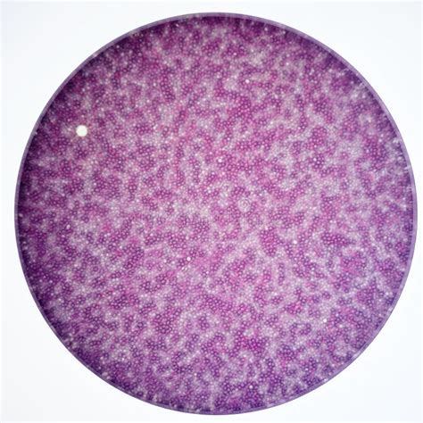 Common Fungus Stock Illustrations 635 Common Fungus Stock Illustrations Vectors And Clipart