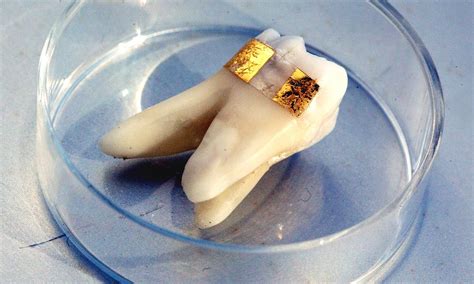 Could An Ultra Thin Sensor On Your Teeth Save Your Life New Electronic
