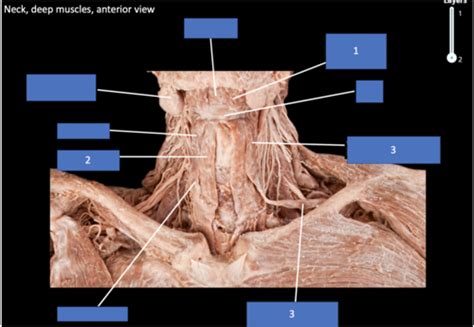 Anterior Neck Muscles Cadaver