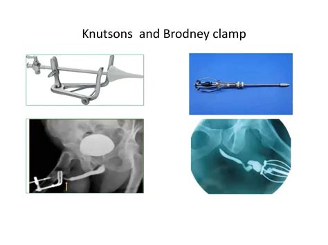 Retrograde Urethrogram For Urology Residents Pptx