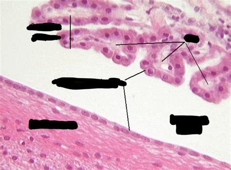 Diagram Of Choroid Plexus Ependymal Cells Quizlet