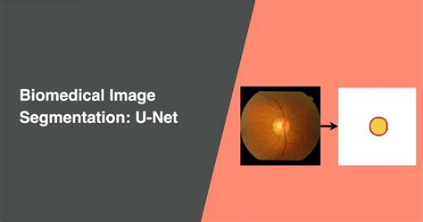 Biomedical Image Segmentation U Net By Jingles Hong Jing Tds