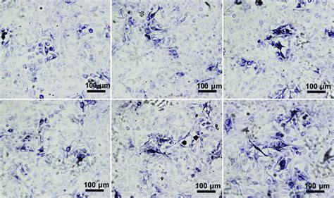 Fluorescence Staining Results Of Cells After 7 Days Culture