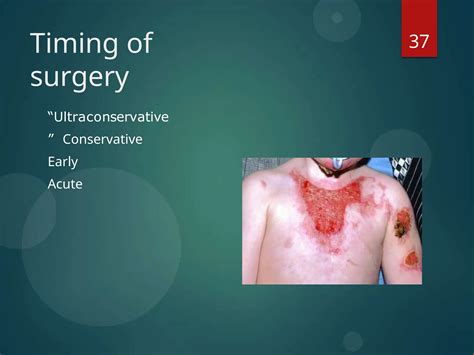 Burn Historyphysical Examination Of Burn And Pathophysiologypptx