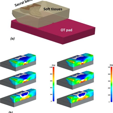 Computational Finite Element Fe Modeling Simulating The