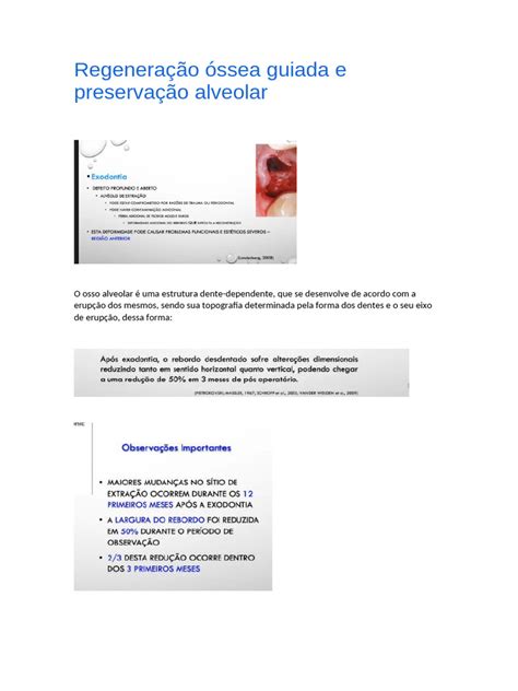Regeneração Óssea Guiada E Preservação Alveolar Pdf