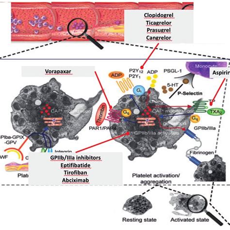 Overview Of Platelet Inhibition Antithrombotic Treatments And Download Scientific Diagram