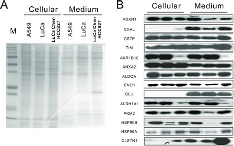Protein Expression Of Identified Secreted Proteins In Cellular And