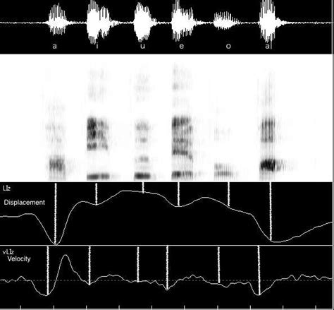 An Example Illustrative Figure Of Mview Screen For Ema Measurement Download Scientific Diagram