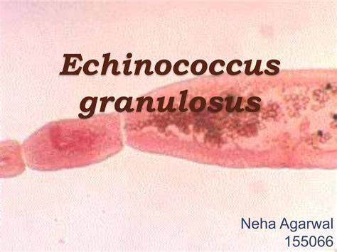 Echinococcus Granulosus Pptx