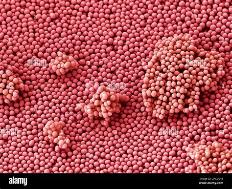 Streptococcus Bacteria Coloured Scanning Electron Micrograph Sem Of