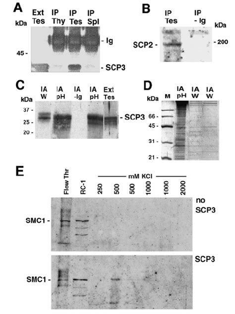 Immunoprecipitation Immunoaffinity And Direct Affinity Chromatography
