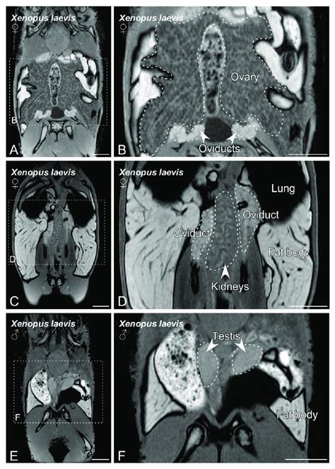 Mri Slices Selected To Illustrate The Main Sex Organs Of The Xenopus