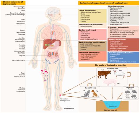 Weils Disease In An Hiv Infected Patient A Case Report And Literature
