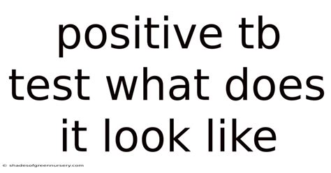 Positive Tb Test What Does It Look Like