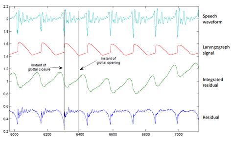 audio estimation of glottal closure instant signal processing stack