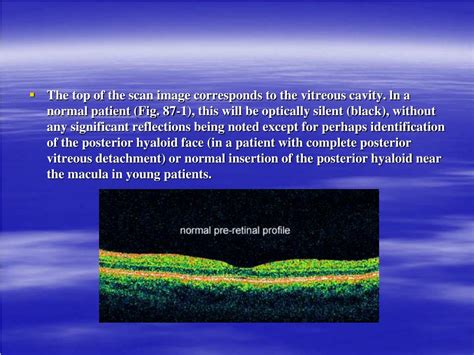 Ppt Oct Interpretation Powerpoint Presentation Free Download Id 5284411