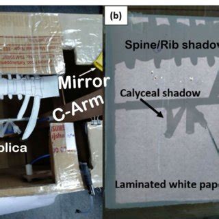 A Replica Of Calyx And Spine And B Calyx Image Captured On Laminated