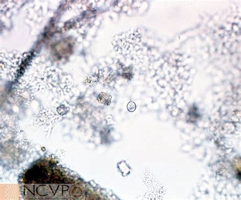 Coccidiosis Wormboss