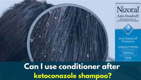 Can I Use Conditioner After Ketoconazole Shampoo