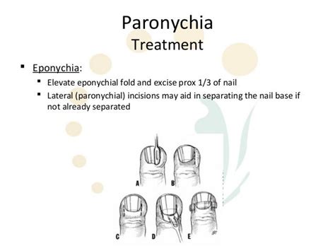 Hand Infections