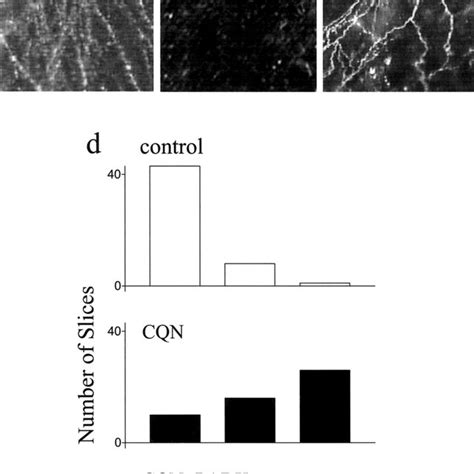 Lysosomal Modulation Promotes The Recovery Of Transport Capability In