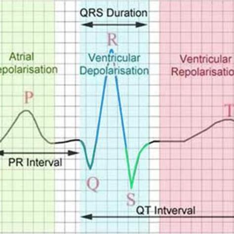 A Normal Ecg Waveform 1 Download Scientific Diagram