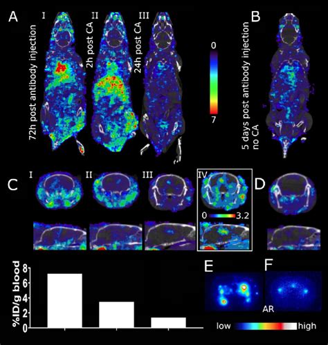 A Whole Body Spect Scans Of 18−20 Month Old Tg Arcswe Mouse Injected Download Scientific