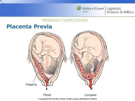 Chapter 12 Care Of The Obstetric Patient Copyright
