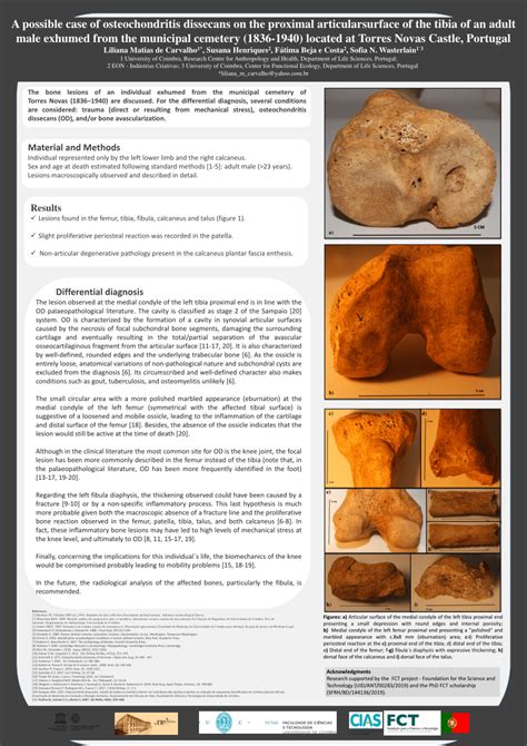 Pdf A Possible Case Of Osteochondritis Dissecans On The Proximal Articularsurface Of The Tibia