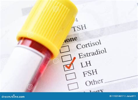 Luteinizing Hormone Test Stock Image Image Of Hormone 115314617