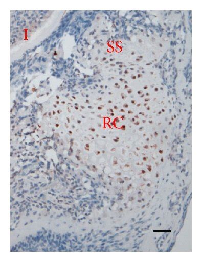 immunohistochemistry of sox9 and runx2 in mandibular cartilages of mice