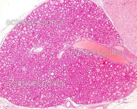 Thyroid Gland Light Micrograph Stock Image Science Source Images