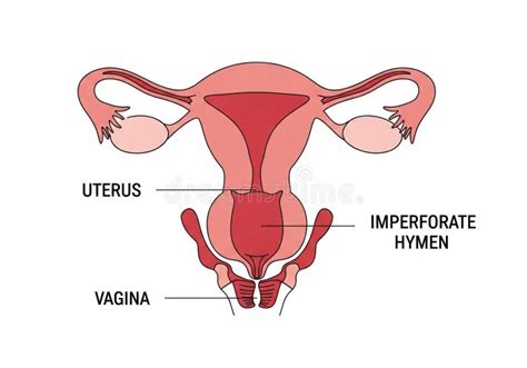 Illustration Of Female Reproductive Anatomy Highlighting An Stock