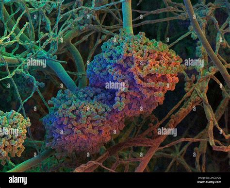 Aspergillus Fumigatus Coloured Scanning Electron Micrograph Sem Of